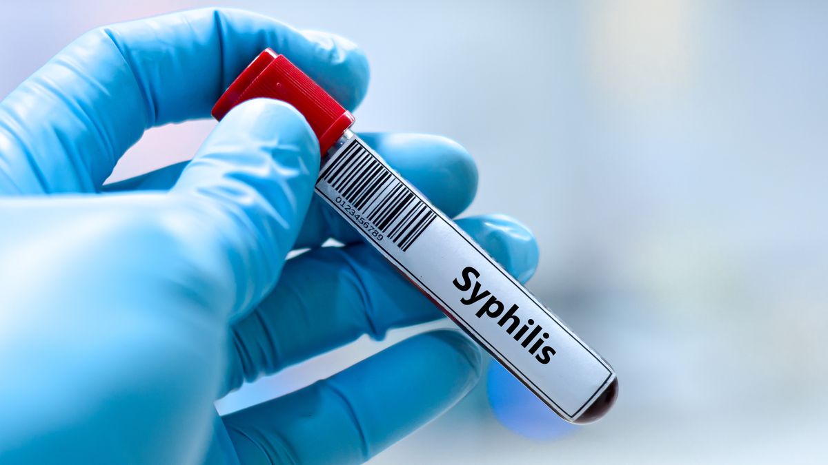 Tripper und Syphilis: Geschlechtskrankheiten breiten sich in Europa aus ...